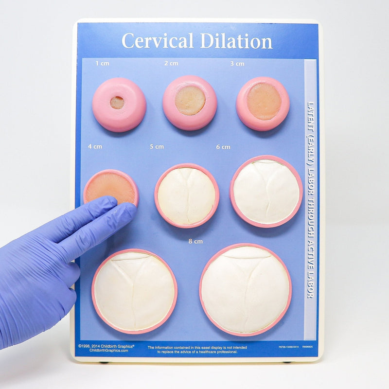 Cervical Dilation Model - My Safe Care United States